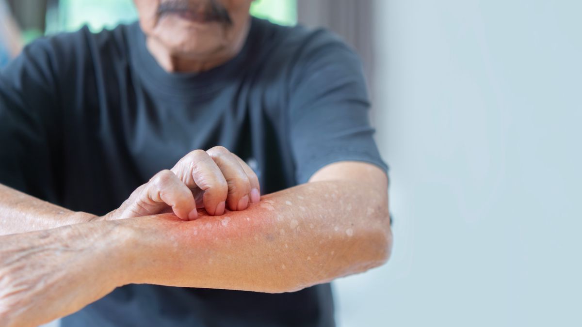 Cinq cas de gale détectés dans un foyer de jour pour personnes âgées à ...
