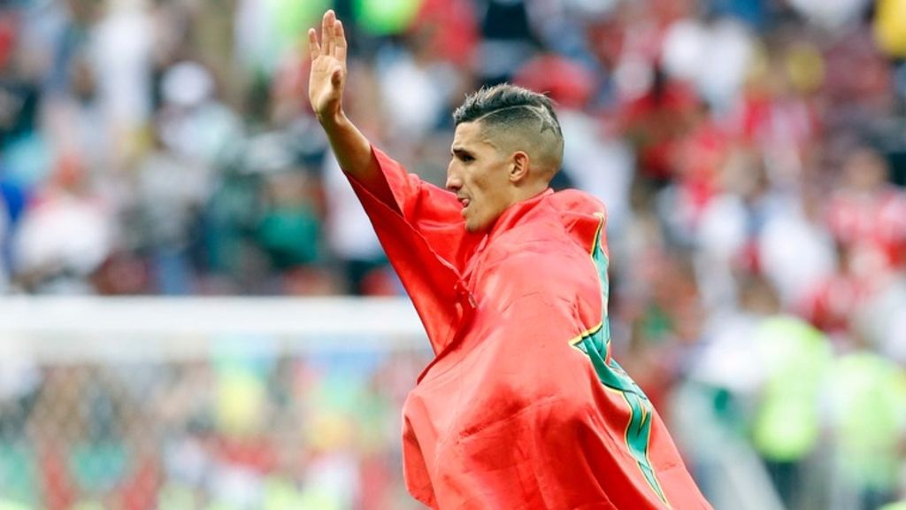 Weltmeister der Herzen | Berner Zeitung