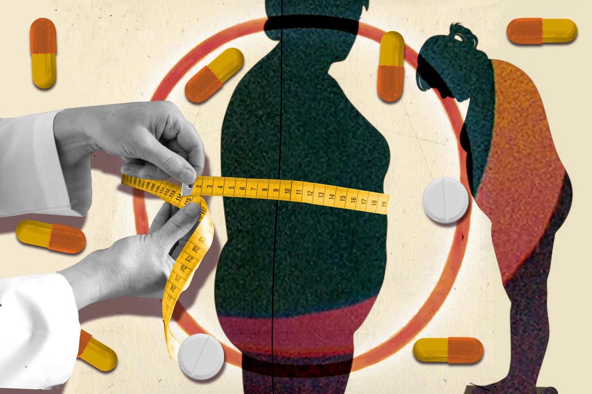 Adipositas: Wie es ist, mit 50 Kilo Übergewicht zu leben | Tages-Anzeiger