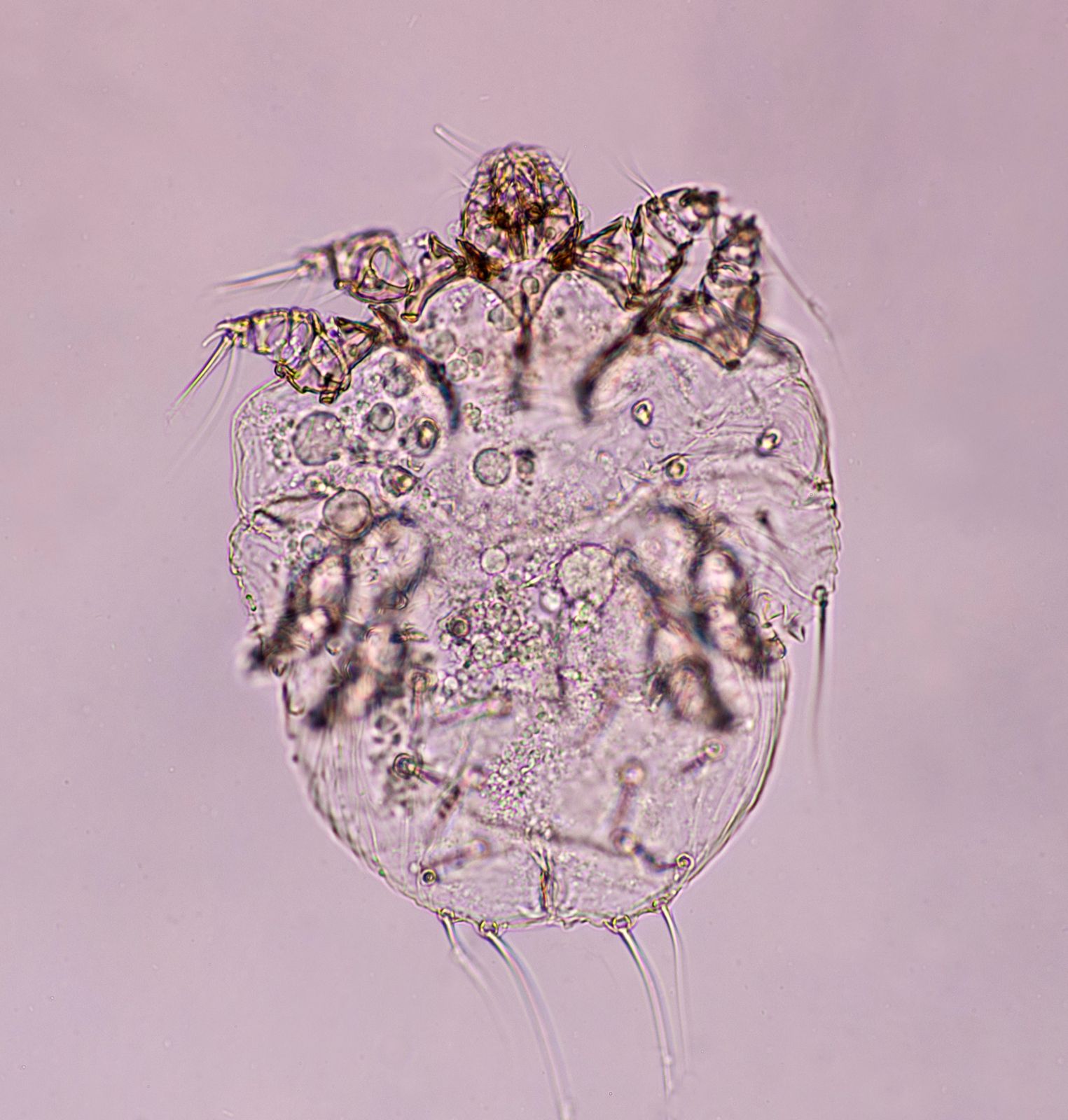 La gale fait-elle son retour dans le canton de Vaud? | 24 heures