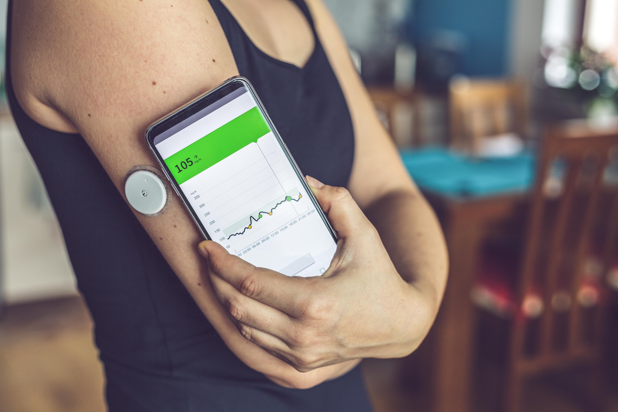 Hot Corner: Kein lästiges Piksen mehr | Finanz und Wirtschaft