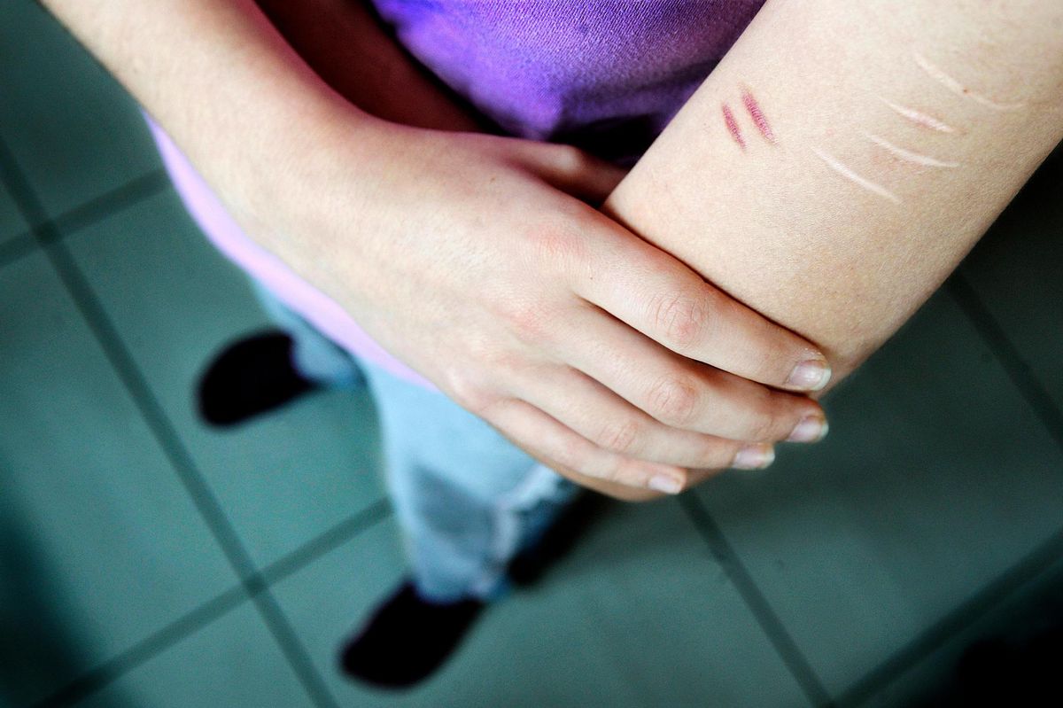 Ritzen bringt «Erleichterung» | Tages-Anzeiger