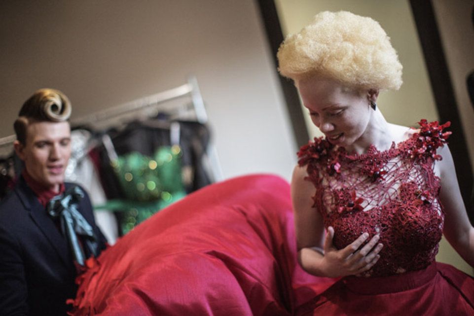 Afrique du Sud: Pour Thando Hopa, on peut être albinos et mannequin ...
