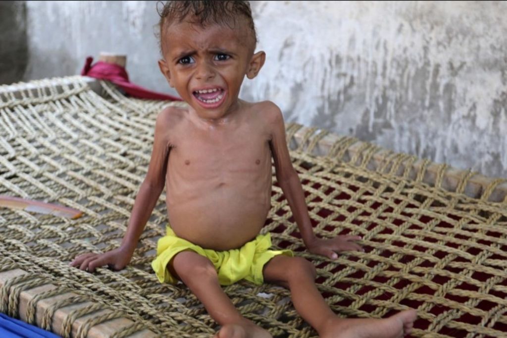 La famine menace plus de cinq millions d'enfants
