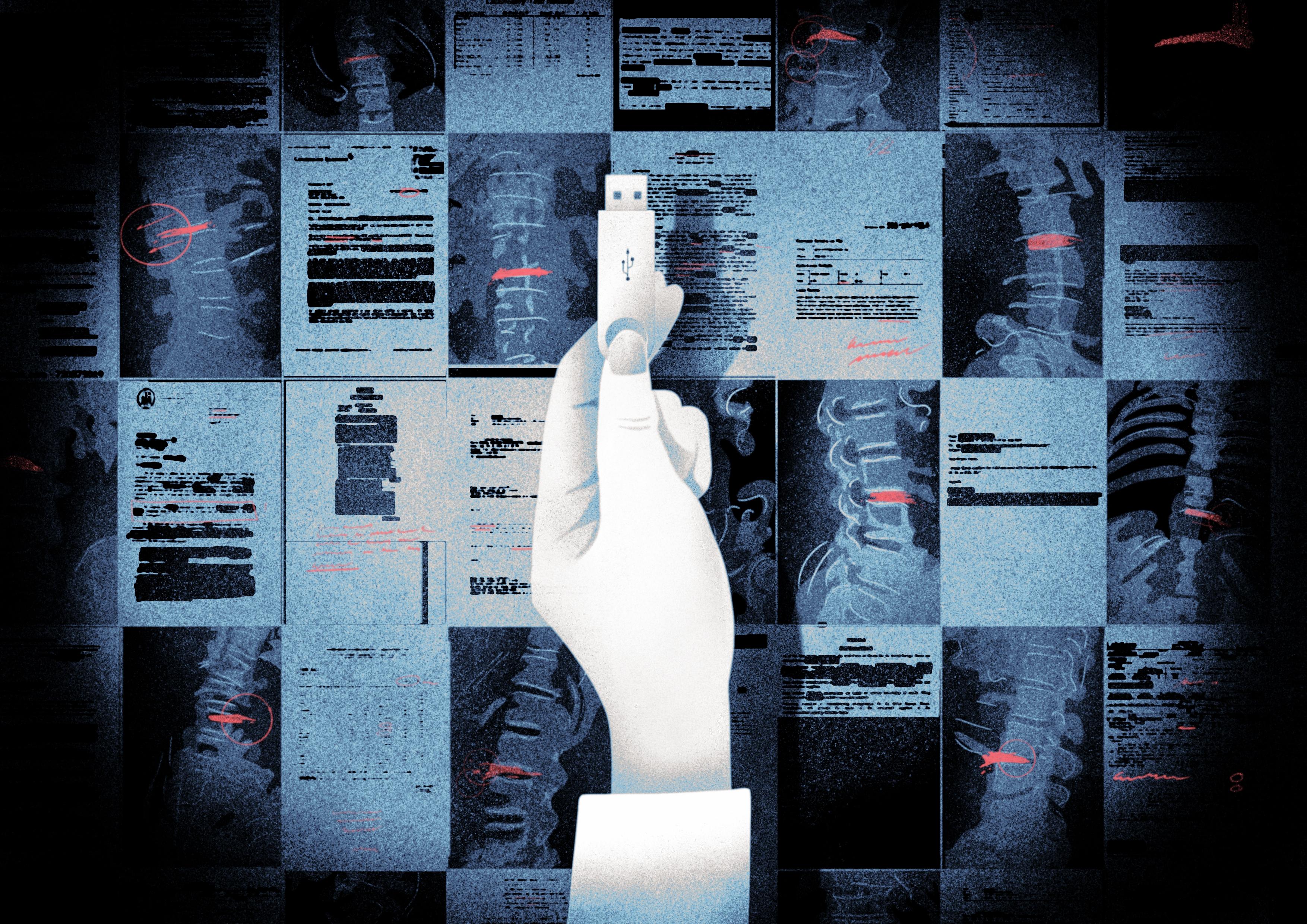 Implantate-Skandal: Schweizer Starchirurg Max Aebi angeklagt