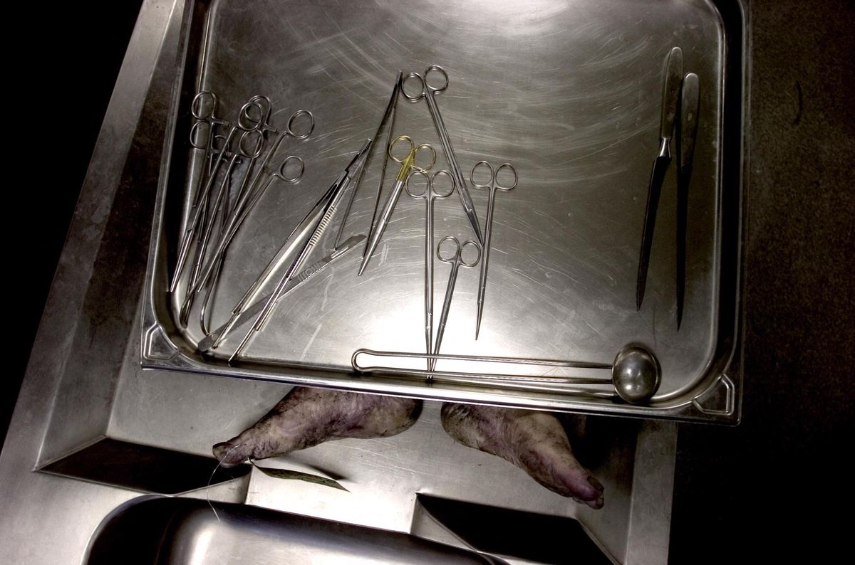 Médecine – Une démonstration publique d’autopsie fait polémique aux ...