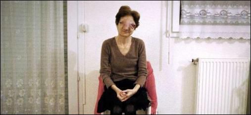 Chantal Sébire a été retrouvée morte - L'essentiel