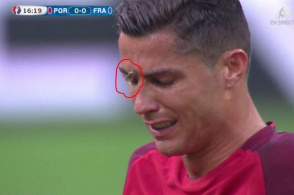 Euro 2016 – Le papillon de Ronaldo est la star de Twitter | 24 heures