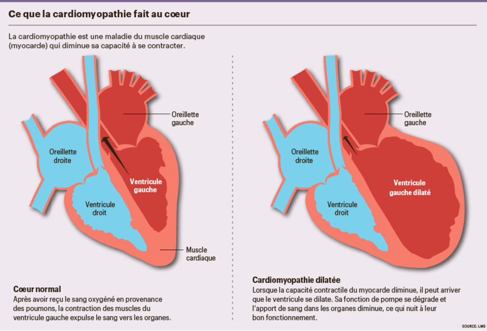 Défaillance: Le cœur envoie des signaux qu'il ne faut pas négliger - Le ...