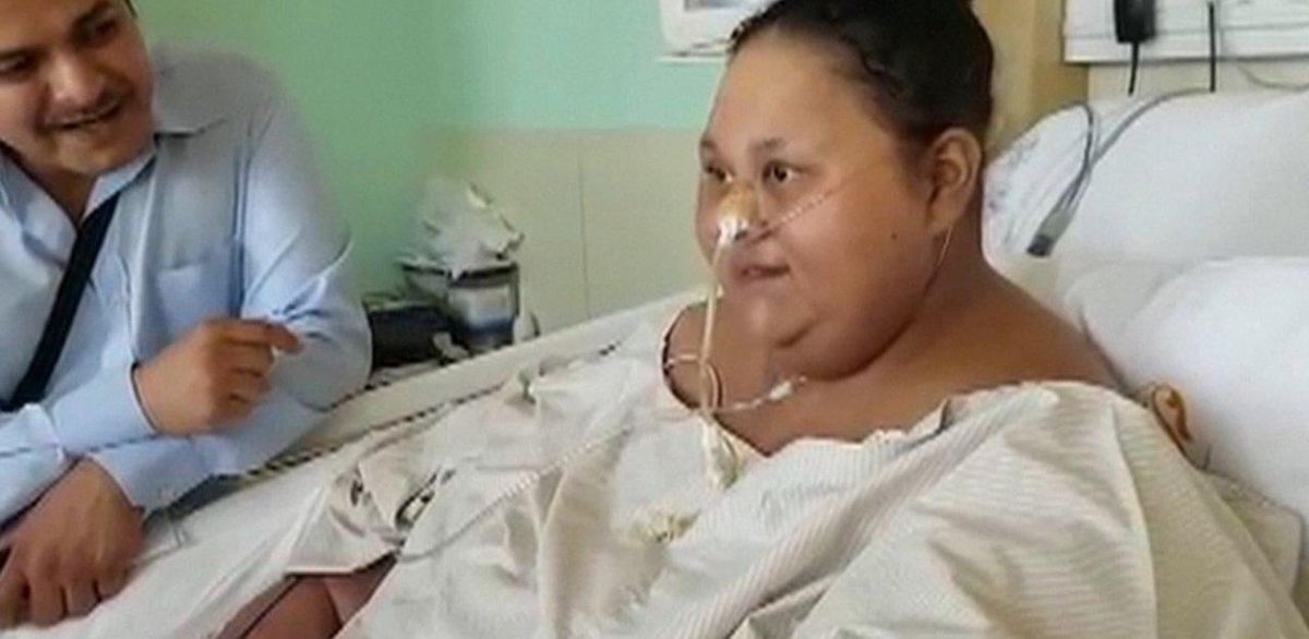 In zwei Monaten – Dickste Frau der Welt speckt 250 Kilo ab - L'essentiel