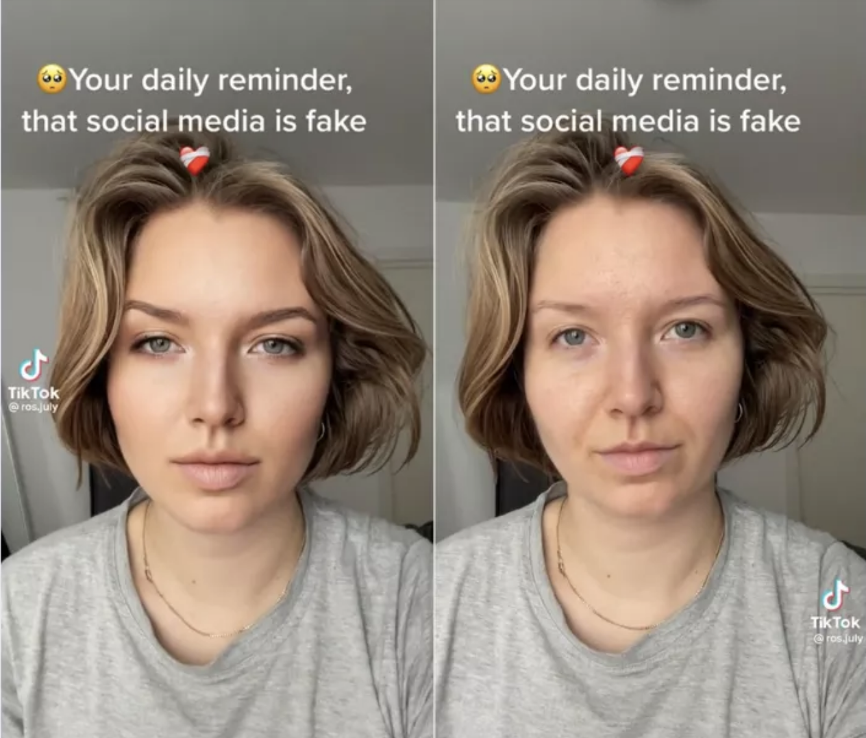 Schönheitsideale auf Social Media: Neues Tiktok-Tool verjüngt Gesichter – und verstört | Der Bund
