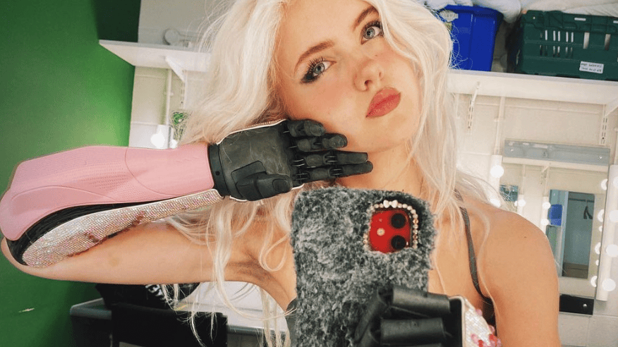 Mit Hightech-Prothesen für Body Positivity: Cyborg-Influencerin kämpft ...