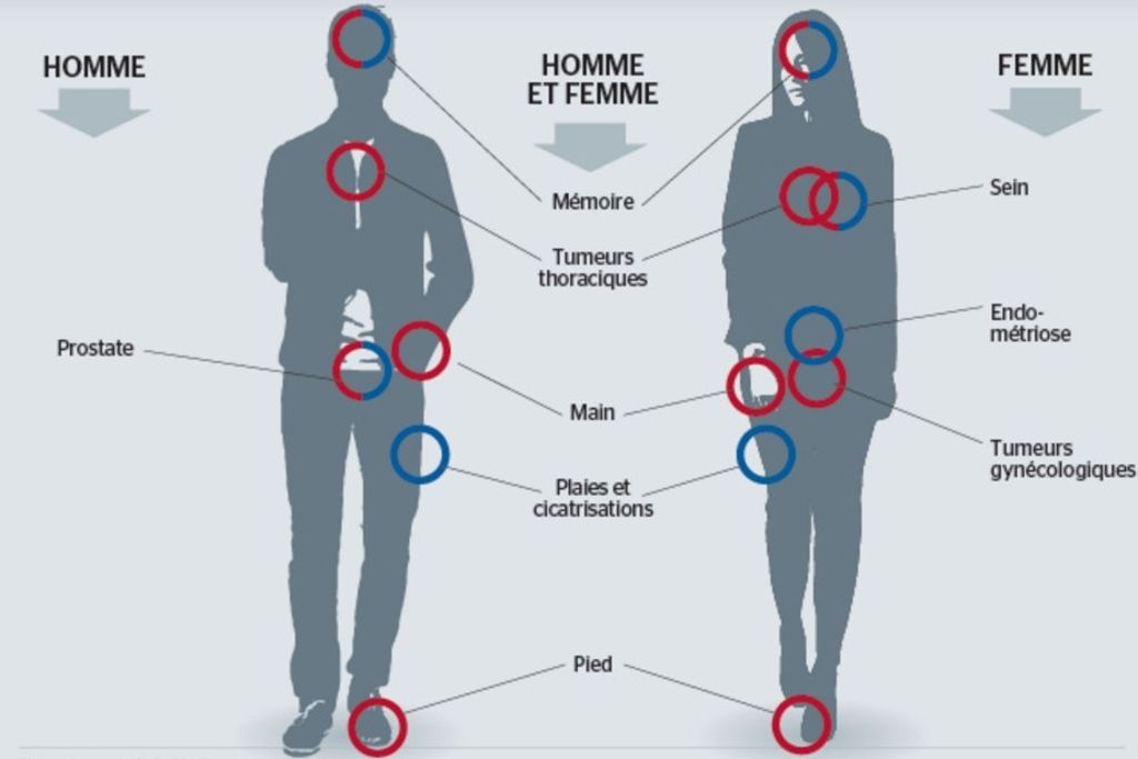 Les centres dédiés à un organe se multiplient | 24 heures