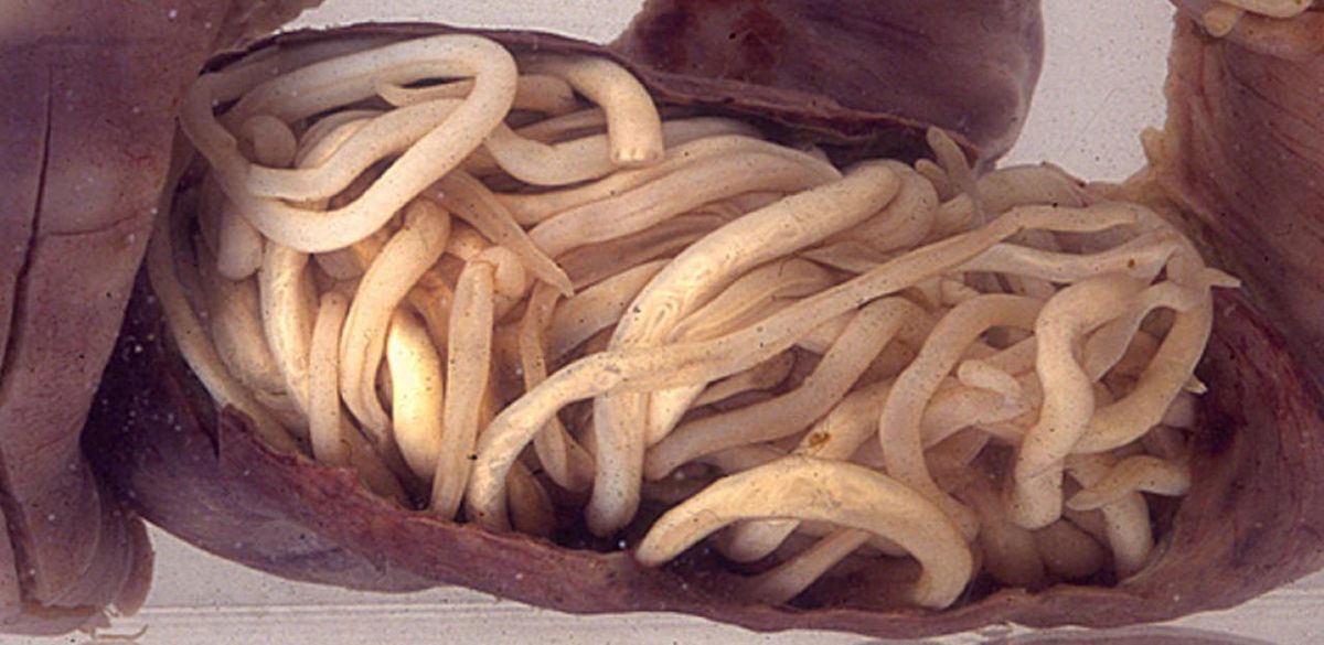 Krankmacher – Die 15 übelsten Parasiten, die im Essen lauern - L'essentiel