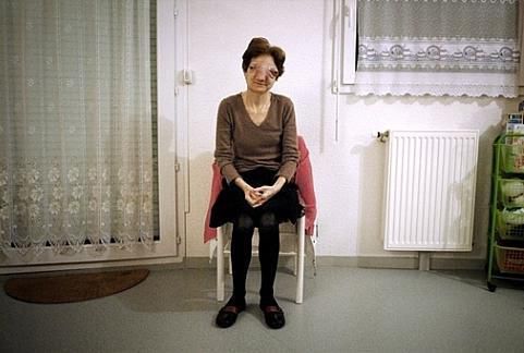 Le dossier Chantal Sébire est clos - L'essentiel