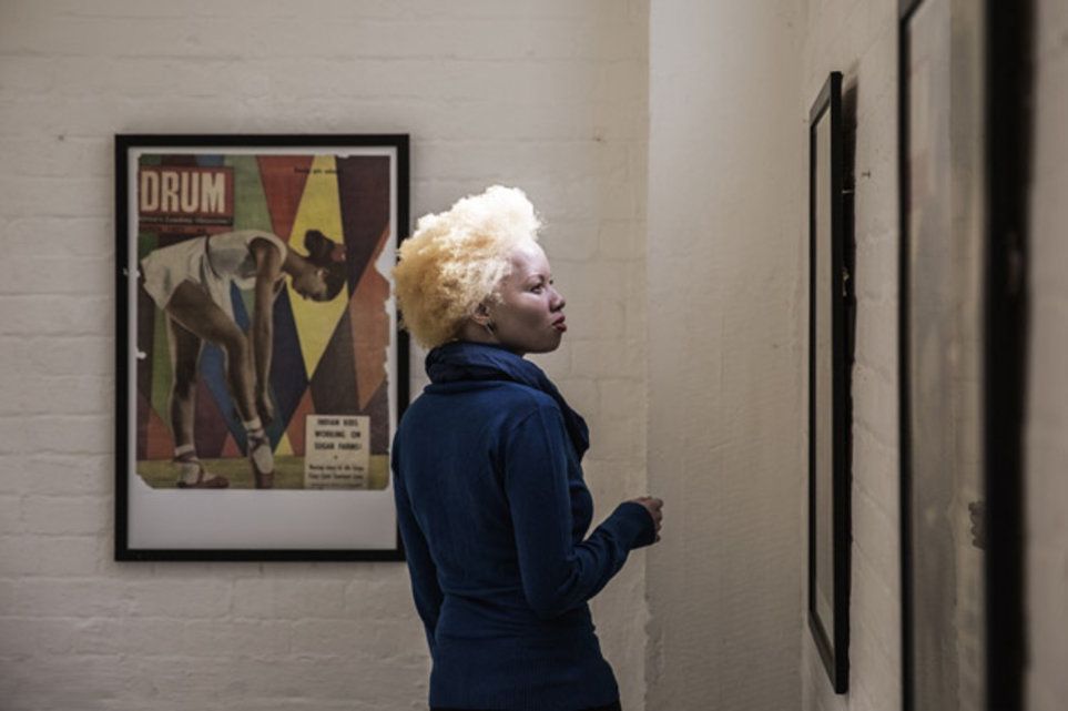 Afrique du Sud: Pour Thando Hopa, on peut être albinos et mannequin ...