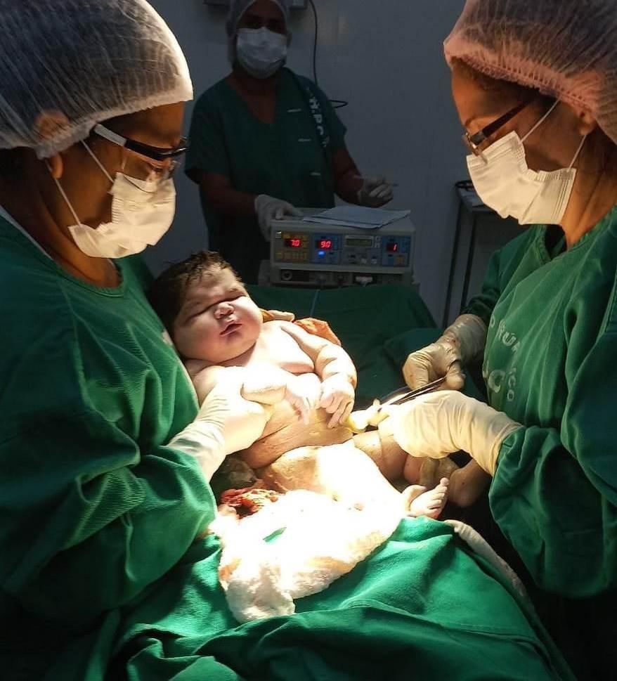 Brasilien: 7,3 Kilogramm schweres Baby – Angerson trägt bereits ...