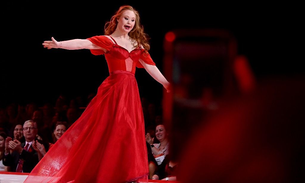 Madeline – das Supermodel mit Downsyndrom | Berner Zeitung
