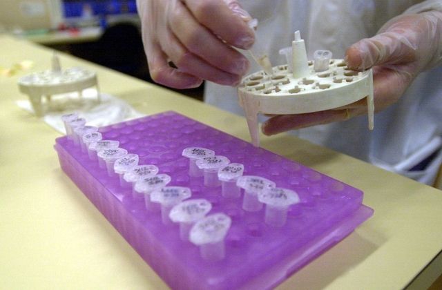 Les tests ADN freinés par la procédure | 24 heures