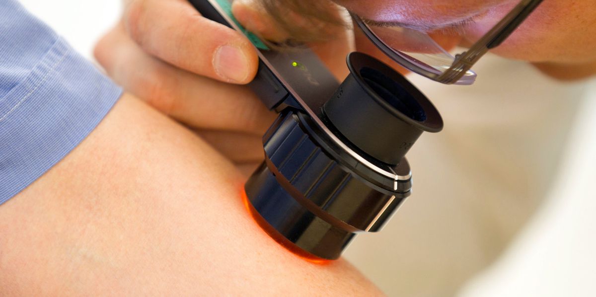 Krebsforschung: Zürcher Entdeckung könnte bei der Früh­erkennung helfen ...